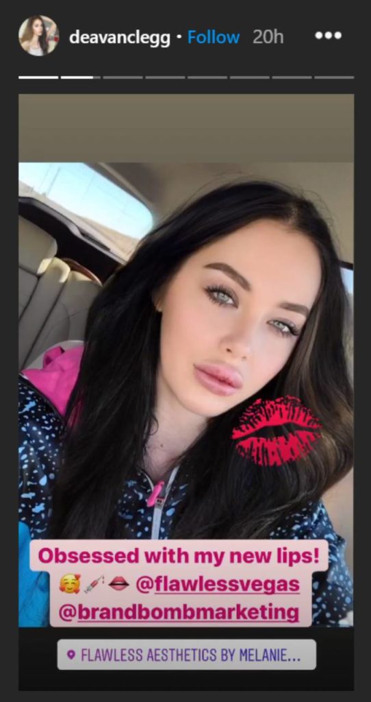 Deavan Clegg shows off biggest lips yet as 90 Day Fiance star undergoes ...