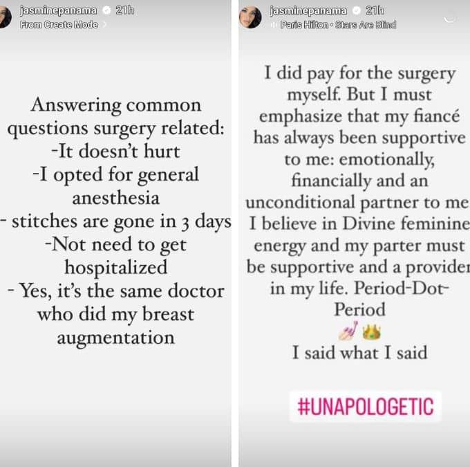 90 Day Fiance alum Jasmine Pineda undergoes plastic surgery on her eyes ...